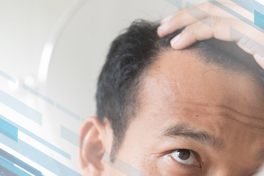 Pepfactor Relux | Relux For Alopecia | Norwest NSW