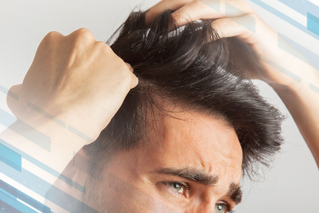 PepFactor Scalp Treatment | Scalp Rejuvenation | Norwest NSW